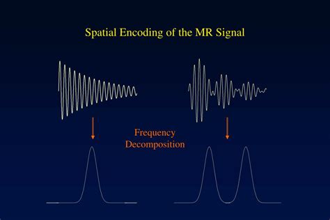 Ppt Principles Of Mri Image Formation Powerpoint Presentation Free