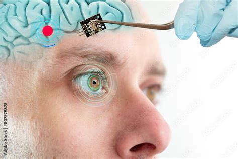 Installing Electronic Chip Into Human Brain Applied In Various Fields Neurotechnology And