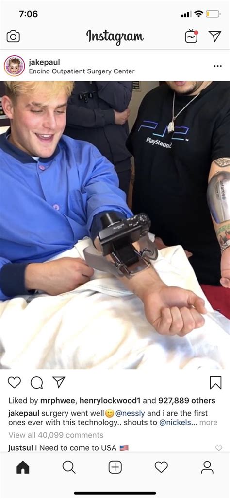 Jake Paul Vlog Arm Jake Paul Gets A Camera Implanted Into His Arm
