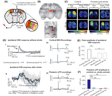 Uncrossed Cortical And Thalamic Circuits To Mediate Sensory Processing Weeks After Stroke