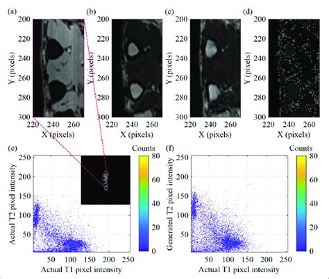 Signal Intensity Dependence Analysis Of The Trained Neural Network For