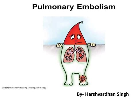 Pulmonary Embolism Radiology Imaging Pptx
