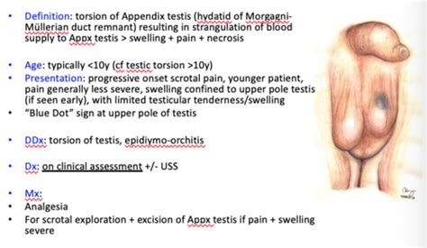 Torsion Of Appendix Testis Blue Dot Sign