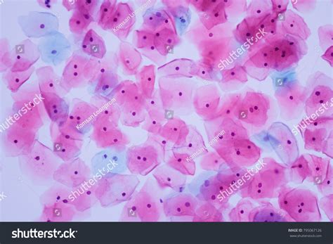 Human Epithelial Cells