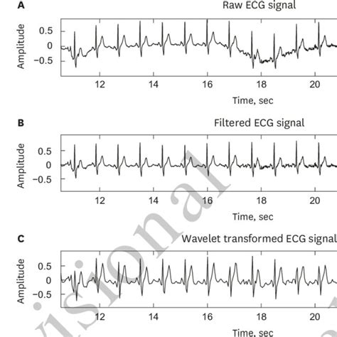 Preprocessing Of The Short Term Normal Ecg Signal A Raw Ecg Signal