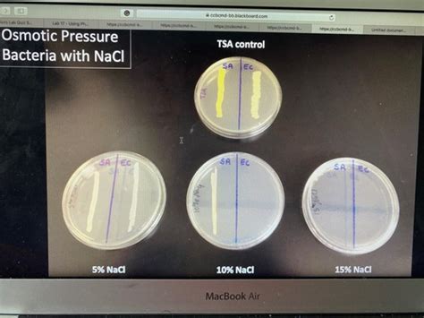 Micro Lab Quiz 5 Flashcards Quizlet