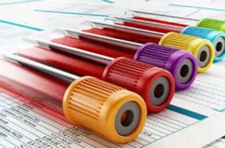 How To Order Your Own Lab Tests Natural Thyroid Guide