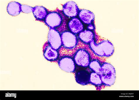 Rubeola Virus Microscope