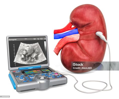 신장 초음파 개념 의학 초음파 진단 기계 백색 배경에 고립 된 3d 렌더링을 가진 인간적 인 신장 약에 대한 스톡 사진 및 기타 이미지 Istock