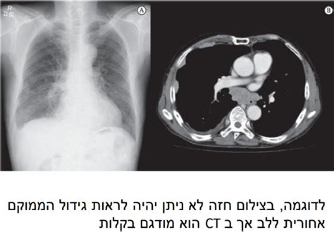 Imaging Modalities Flashcards Quizlet