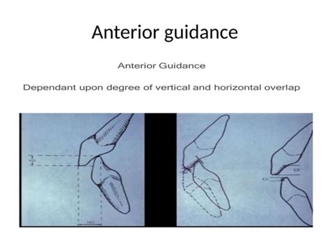 5th L Mutually Protected Occlusionpptx