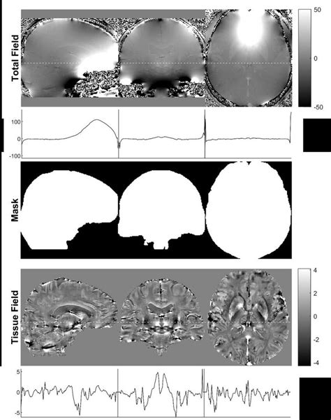 Process Of Background Field Removal Estimates The Background Field Download Scientific Diagram