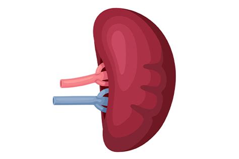 Atraumatic Spontaneous Splenic Rupture In A Female Covid 19 Patient