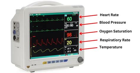 How to Read a Hospital Patient Monitor - Unison Bio-Medical