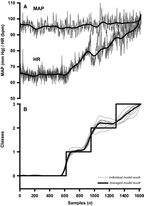 Detecting Central Hypovolemia In Simulated Hypovolemic Shock By Automated Feature Extraction