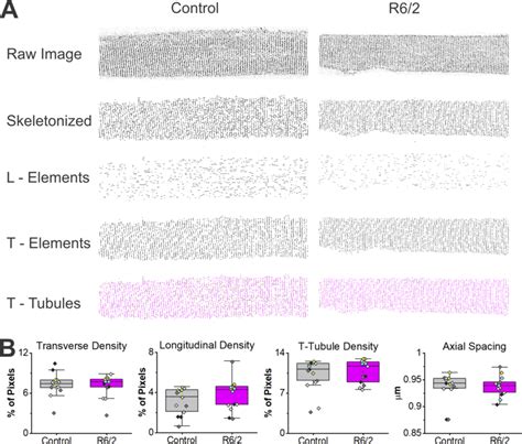 Conserved Whole Cell T Tubule Membrane In R6 2 Fdb Muscle Fibers A
