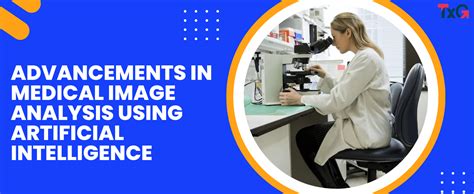 AI Transforming Medical Image Analysis Tecnolynx