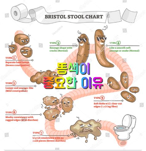 초록색 녹변 똥 설사 증상 및 질병 종류 회색 검은색 빨강 색상별 증상