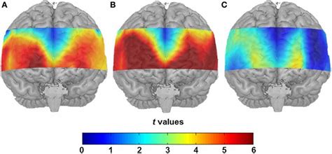 A Statistical Activation Map T Values T Test Against 0 For Download Scientific Diagram