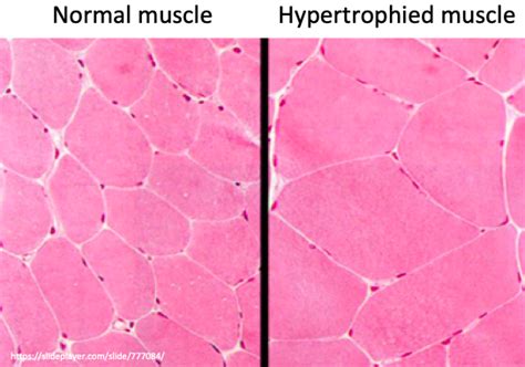 Hypertrophy Muscle Microscope