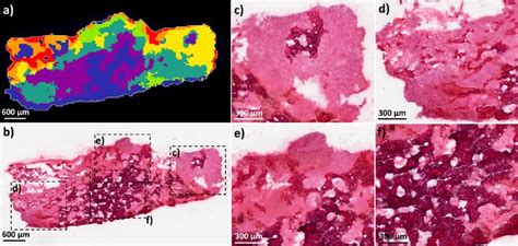 spatial segmentation analysis of os patient 826 tissue sample from