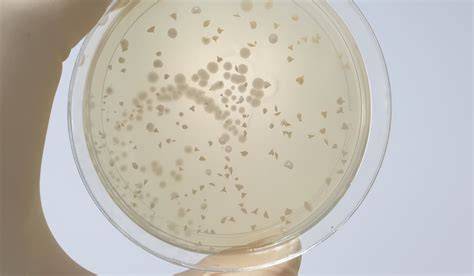 Multiplying Yeast What Is Yeast Propagation Multiplying Yeast What Is Yeast Propagation