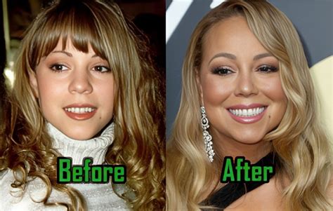 Mariah Carey Plastic Surgery Nose Job Botox Before After