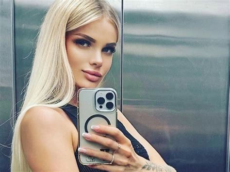 Modelo Rusa Hospitalizada Tras Violenta Agresión De Su Novio