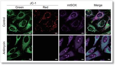 Mtsox Deep Red Mitochondrial Superoxide Detection货号：mt14 日本同仁化学