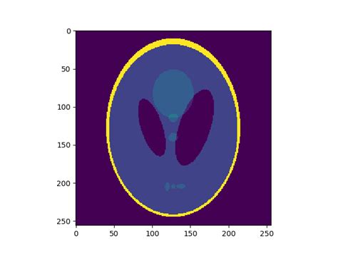 Ct正投影（shepp Logan头模型）如何做到下图效果？编程语言 Csdn问答