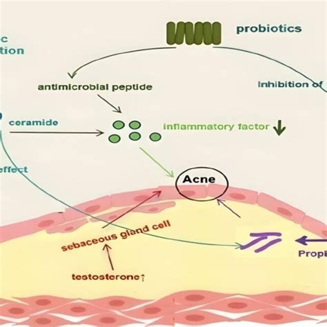 Probiotics In Treatment Of Acne 5 Download Scientific Diagram