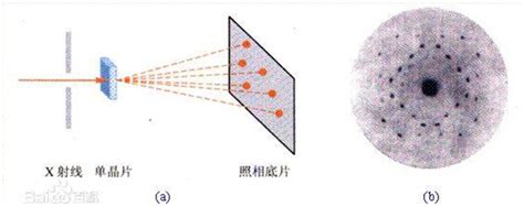 X Ray Diffraction Method Of Calculus Composition Dandong Tongda
