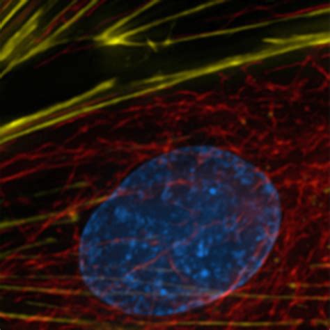 Asia Imaging Autoquant Deconvolution Imaging Solution Asia Imaging Autoquant Deconvolution Imaging Solution