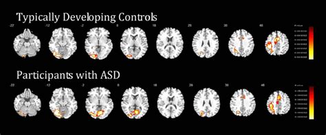 Within Group Differences In The Temporal Discounting Task Horizontal Download Scientific