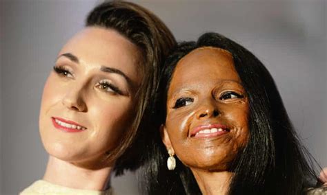 Acid Attack Survivors Take To The Catwalk In London Fashion Show