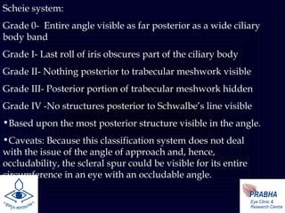 19 Gonioscopy Ppt