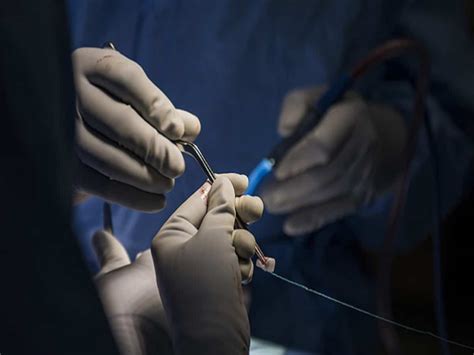 Man With Male Female Reproductive Organs Undergoes Surgery In Hyderabad