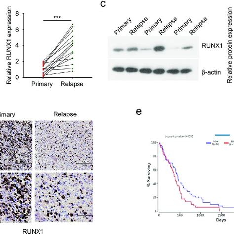 Runx1 Is Highly Expressed In Gbm And Associated With A Poor Prognosis