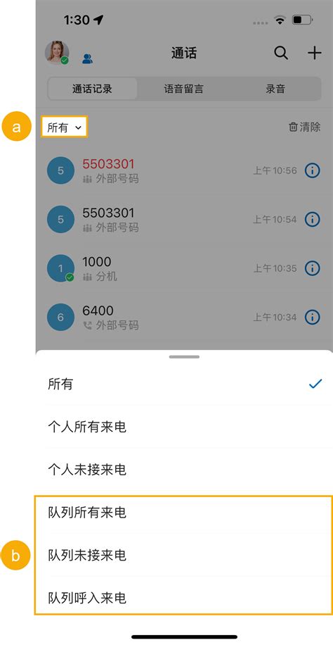 管理队列通话记录