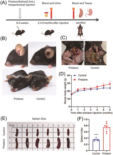 Immune Cell Alterations In A Pristane‐induced Lupus Model In C57bl6j