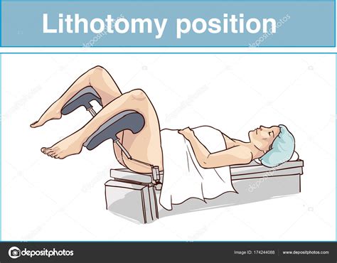Ilustración Vectorial De Una Posición De Litotomía Vector De Stock