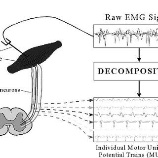 PDF Techniques Of EMG Signal Analysis Detection Processing Classification And Applications