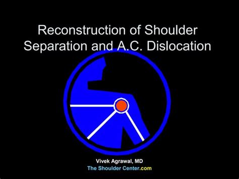 Reconstruction Of Shoulder Separation And Ac Dislocation Ppt