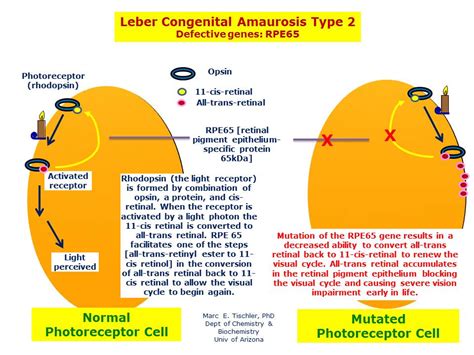 Lebers Congenital Amaurosis Gene Therapy At Haydee Johnson Blog