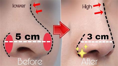Top Exercises For Nose | Practice it Every Day to Have a Perfect ...