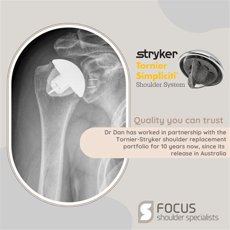 Focus Shoulder Specialists Adelaide Sa