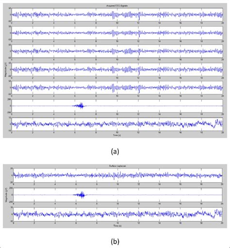 Preprocessing With Surface Laplacian Filtering A Raw Eeg Signals B Download Scientific