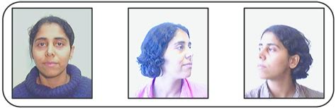 5 Intra Class Variation Associated With An Individuals Face Images
