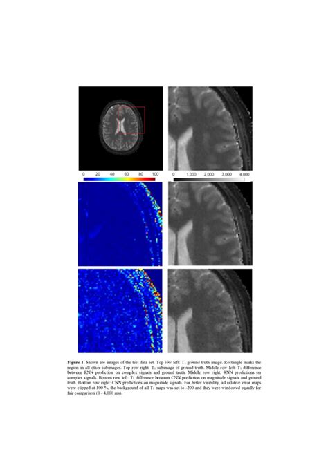 Magnetic Resonance Fingerprinting Reconstruction Using Recurrent Neural Networks Deepai