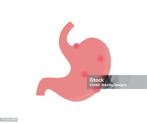 복통의 원인 위궤양 맹장염 또는 위장 시스템 질환으로 고통받는 복통 의료 및 건강 보험 개념 벡터 디자인 및 그림 반란에 대한 스톡 벡터 아트 및 기타 이미지 Istock